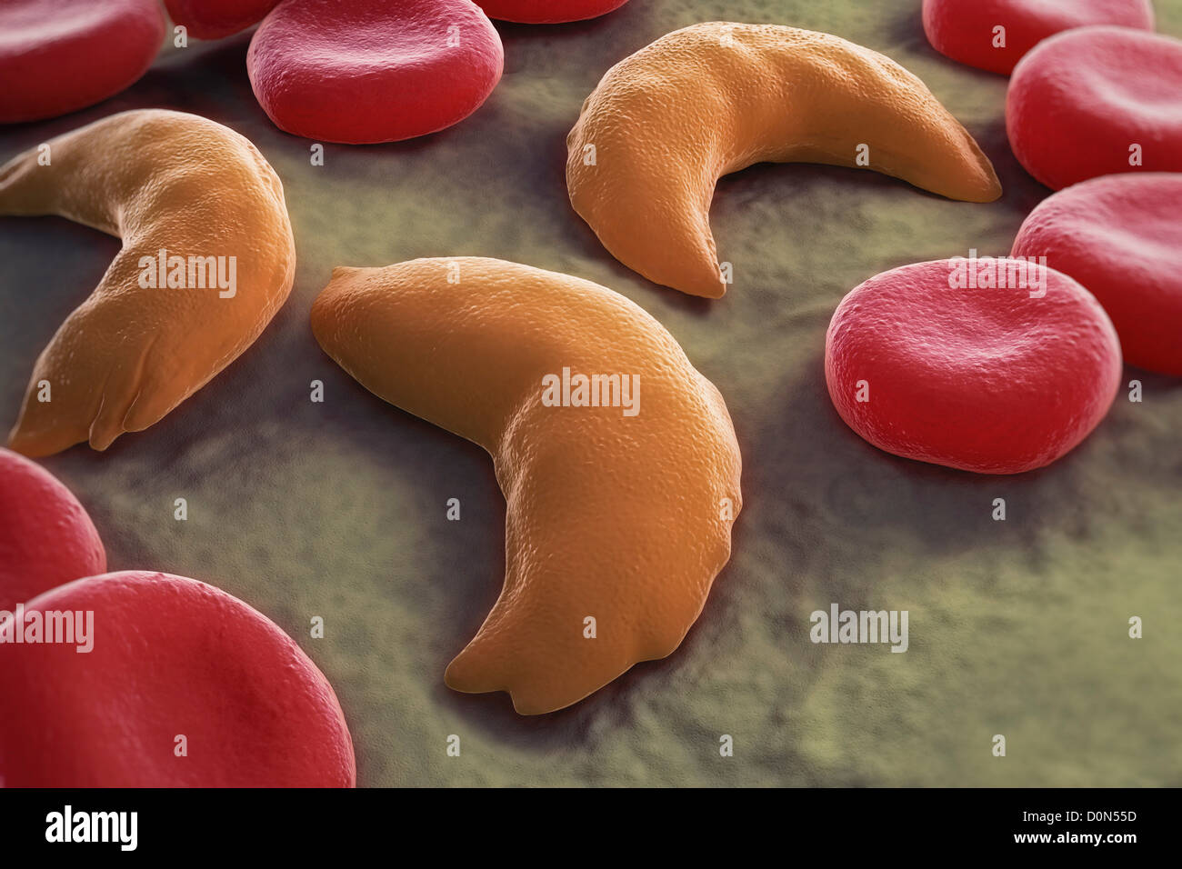 Sickle-cell disease sickle-cell anaemia or drepanocytosis is recessive ...
