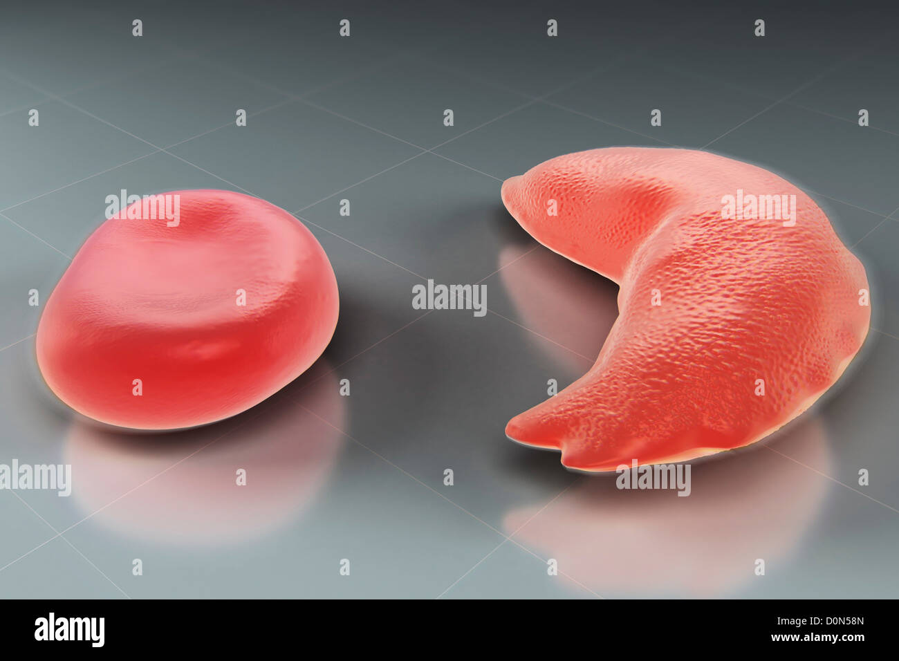 Sickle-cell disease sickle-cell anaemia or drepanocytosis is recessive ...