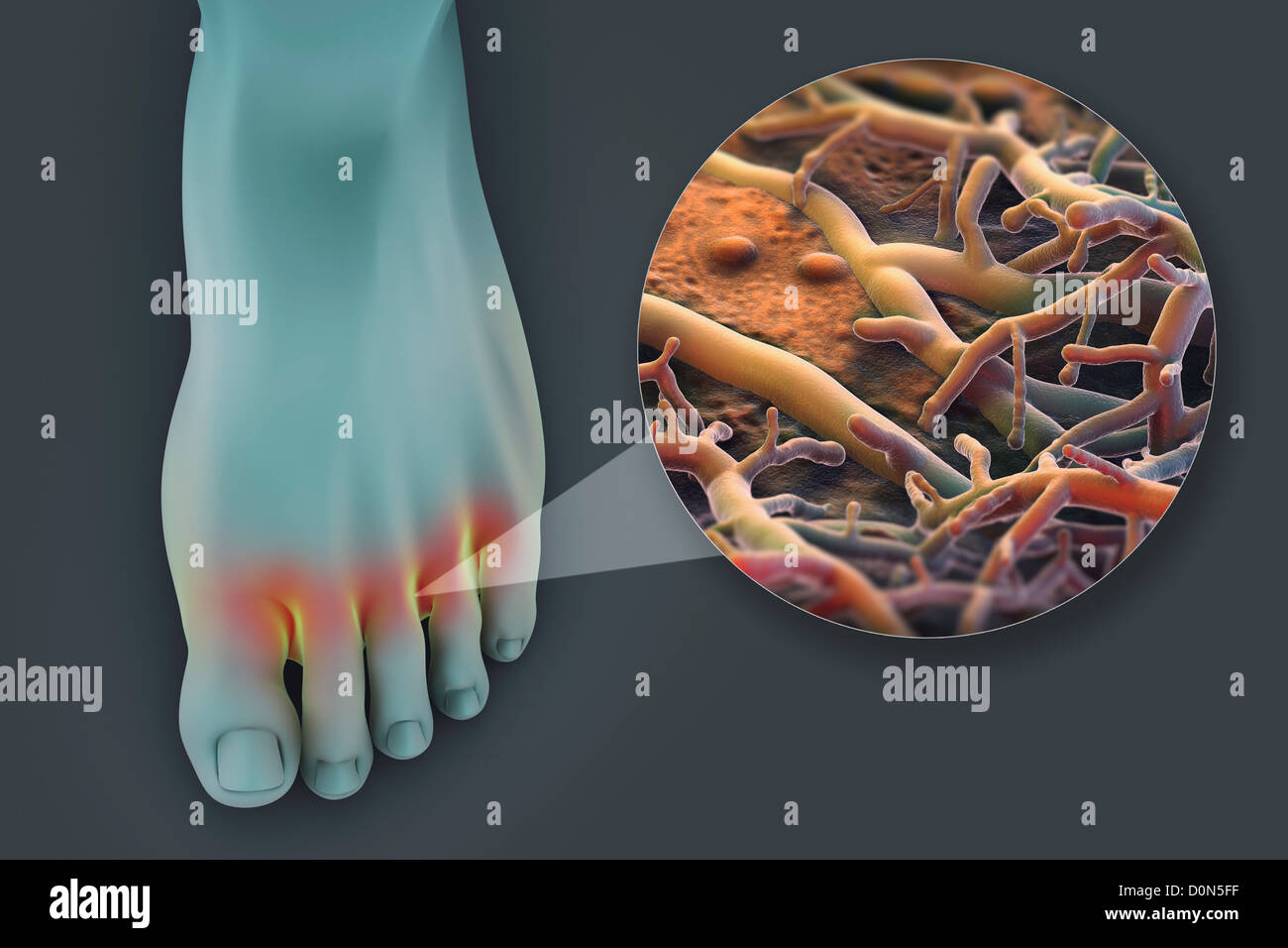 A left foot glowing appearance. foot is highlighted represent presence ...