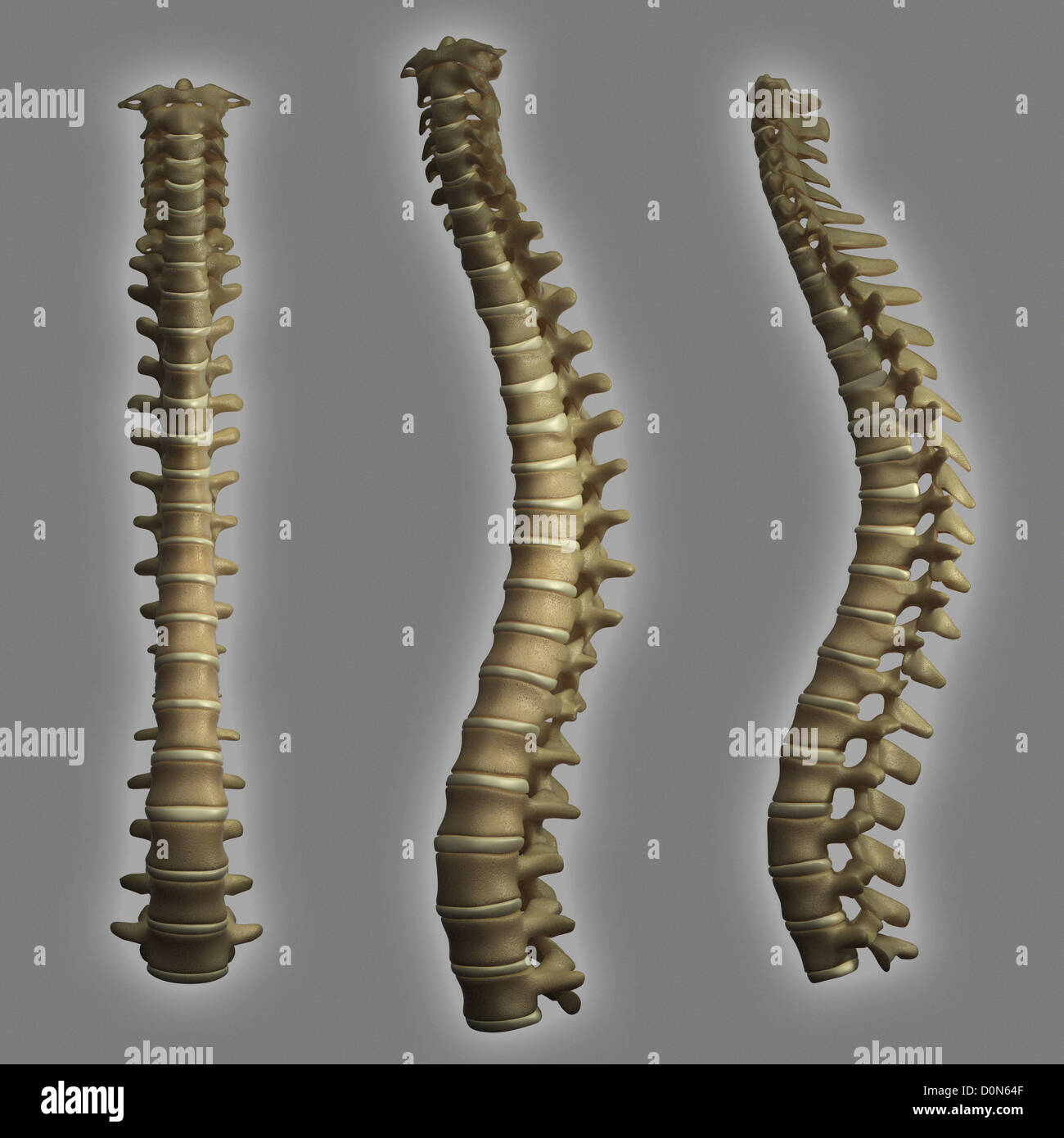 The spine viewed from three perspectives against a gray background. The ...