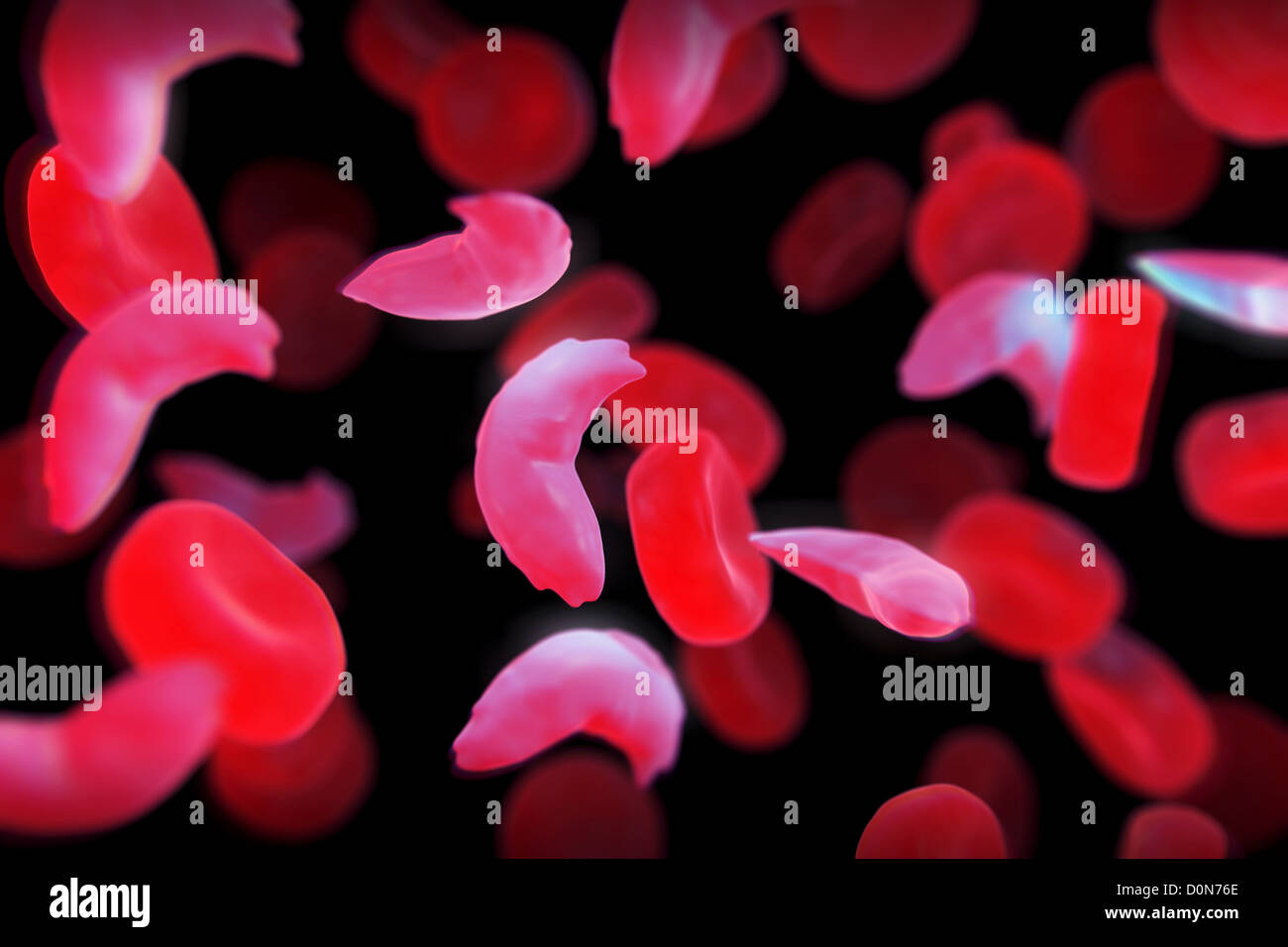 Sickle-cell disease sickle-cell anaemia or drepanocytosis is recessive ...