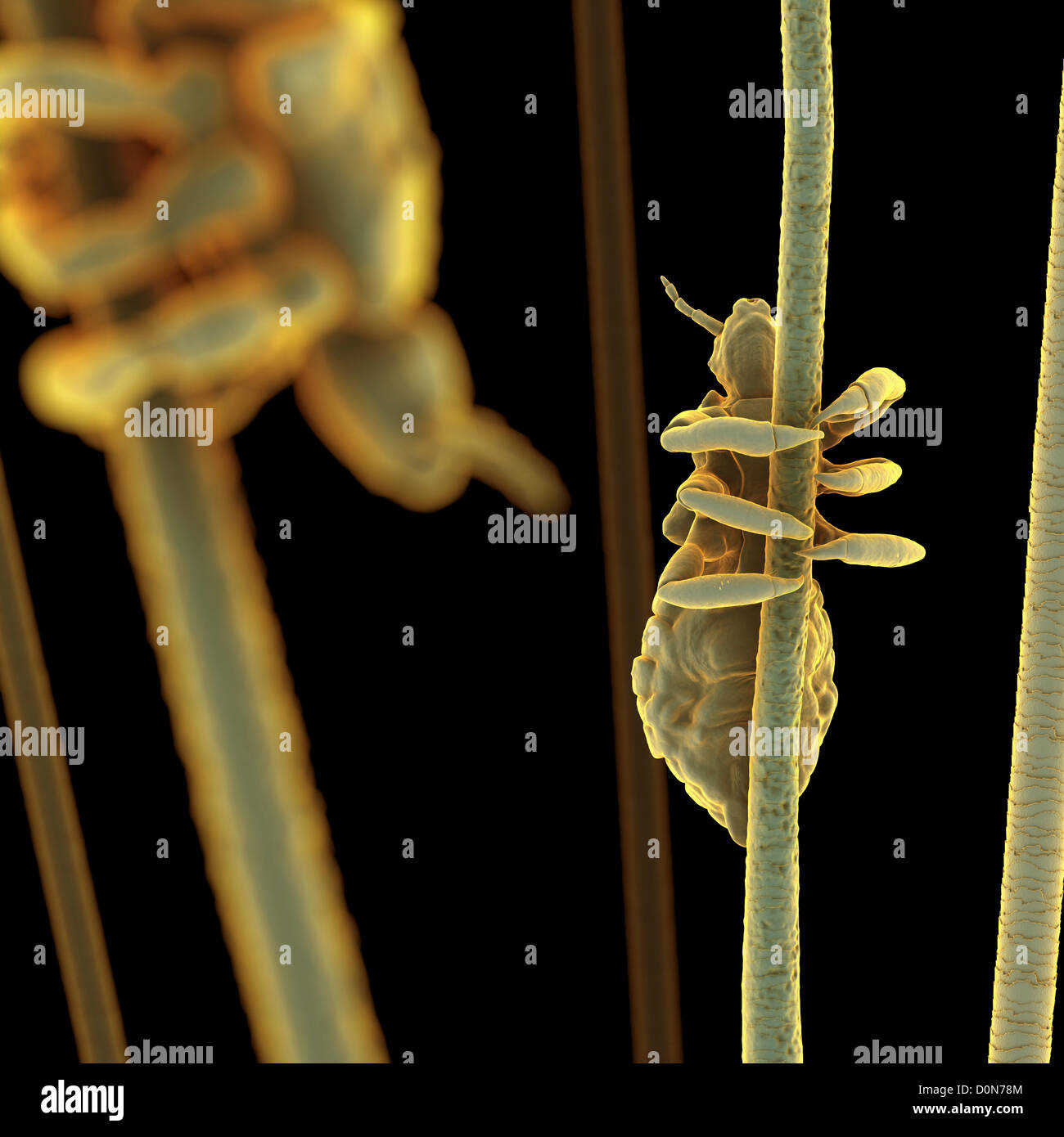 Head lice infestation hi-res stock photography and images - Alamy