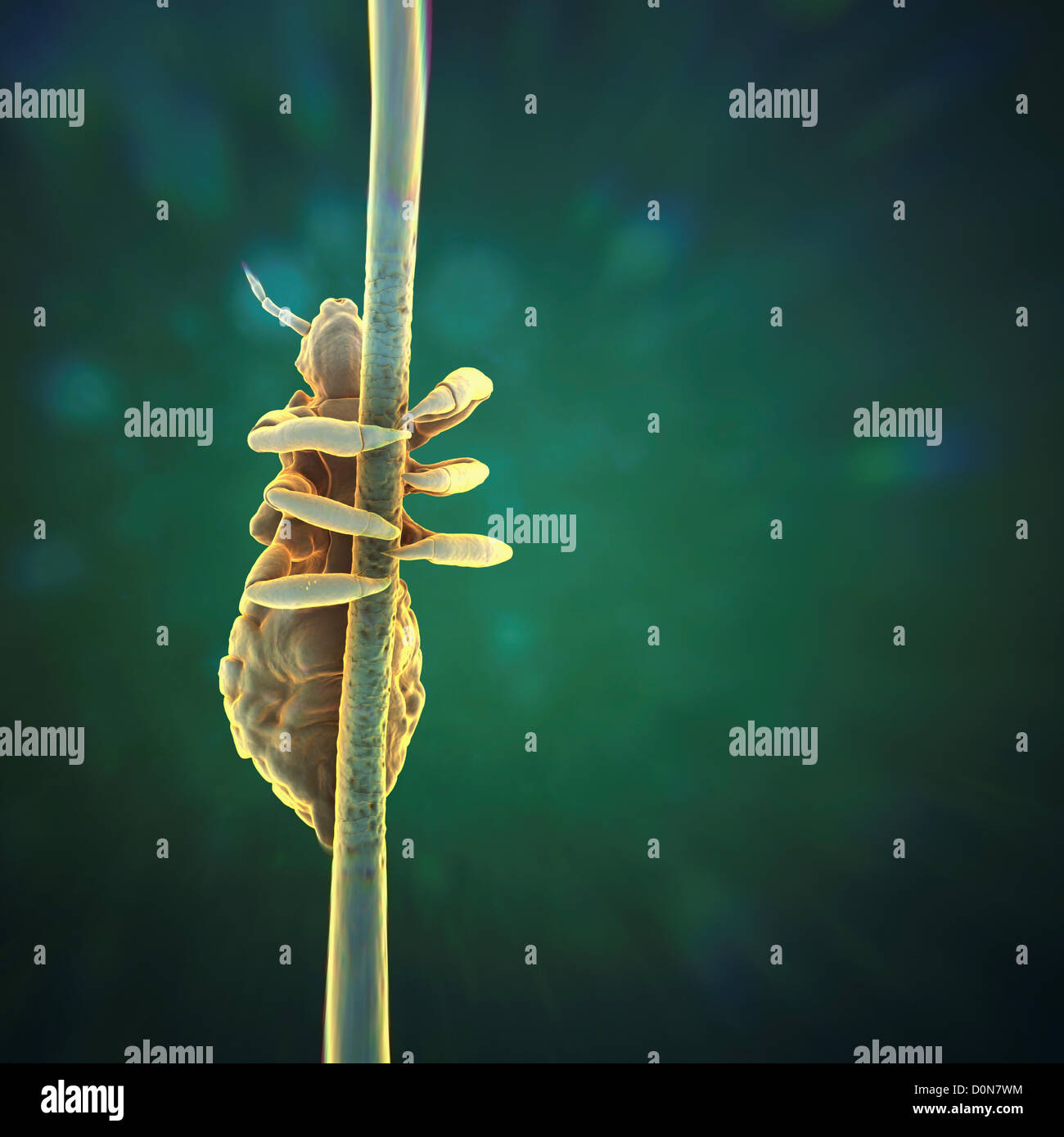 A single head louse clinging to a strand of hair Stock Photo - Alamy