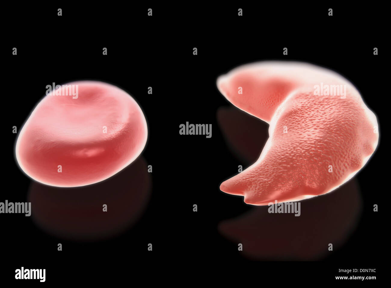 Sickle-cell disease sickle-cell anaemia or drepanocytosis is recessive ...