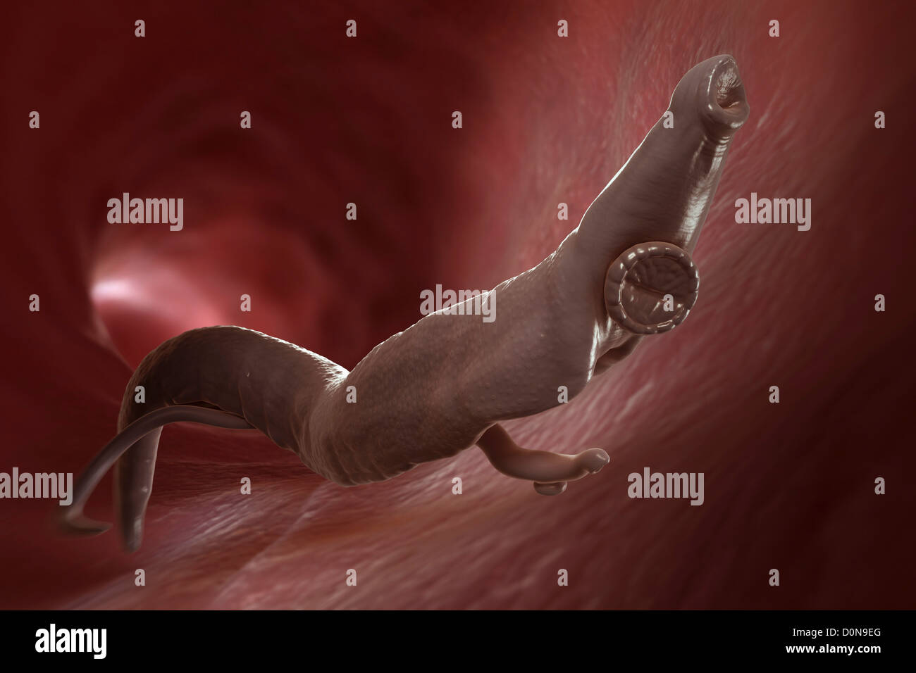 Schistosomiasis also known as snail fever is parasitic disease caused ...