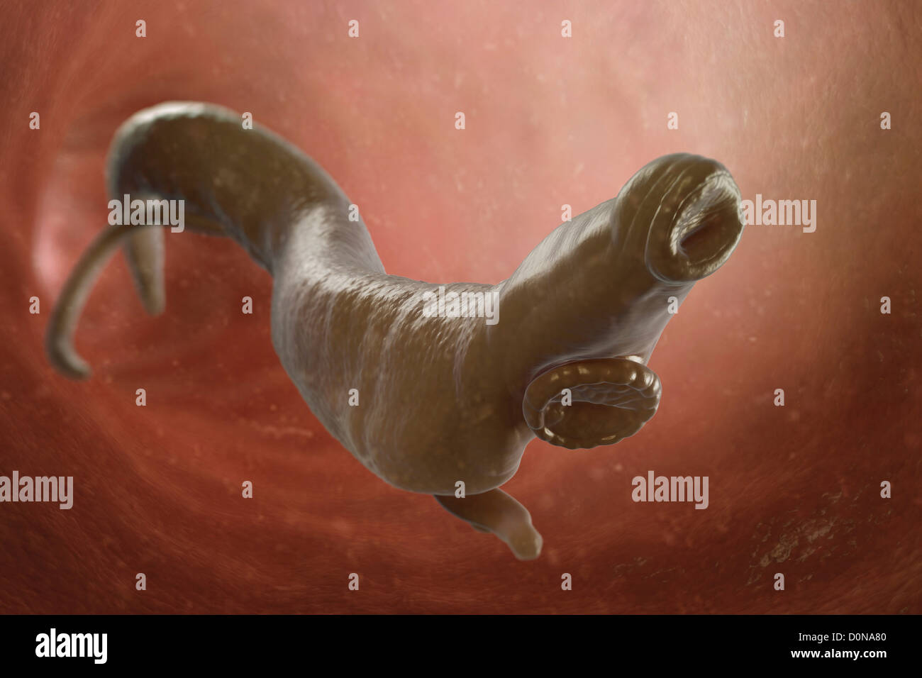 Schistosomiasis also known as snail fever is parasitic disease caused ...