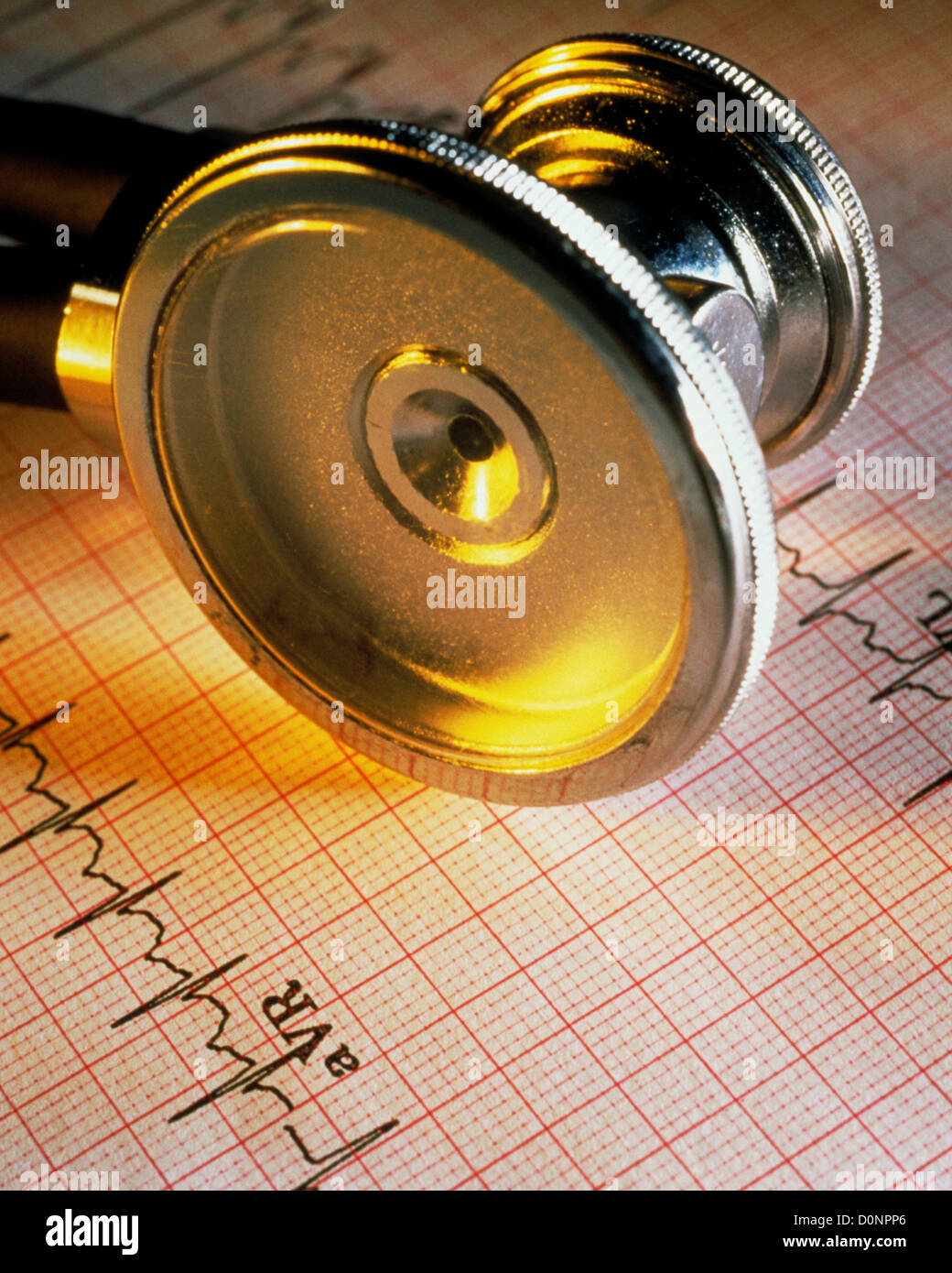 Close-up of Stethoscope on Electrocardiogram Reading Stock Photo - Alamy