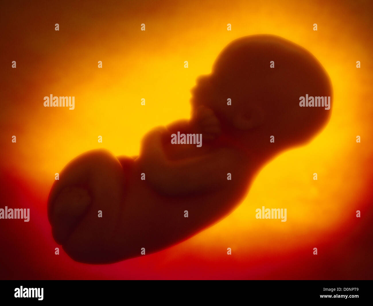 Silhouette of Unborn Fetus (Model) on Yellow Lit Background Stock Photo ...