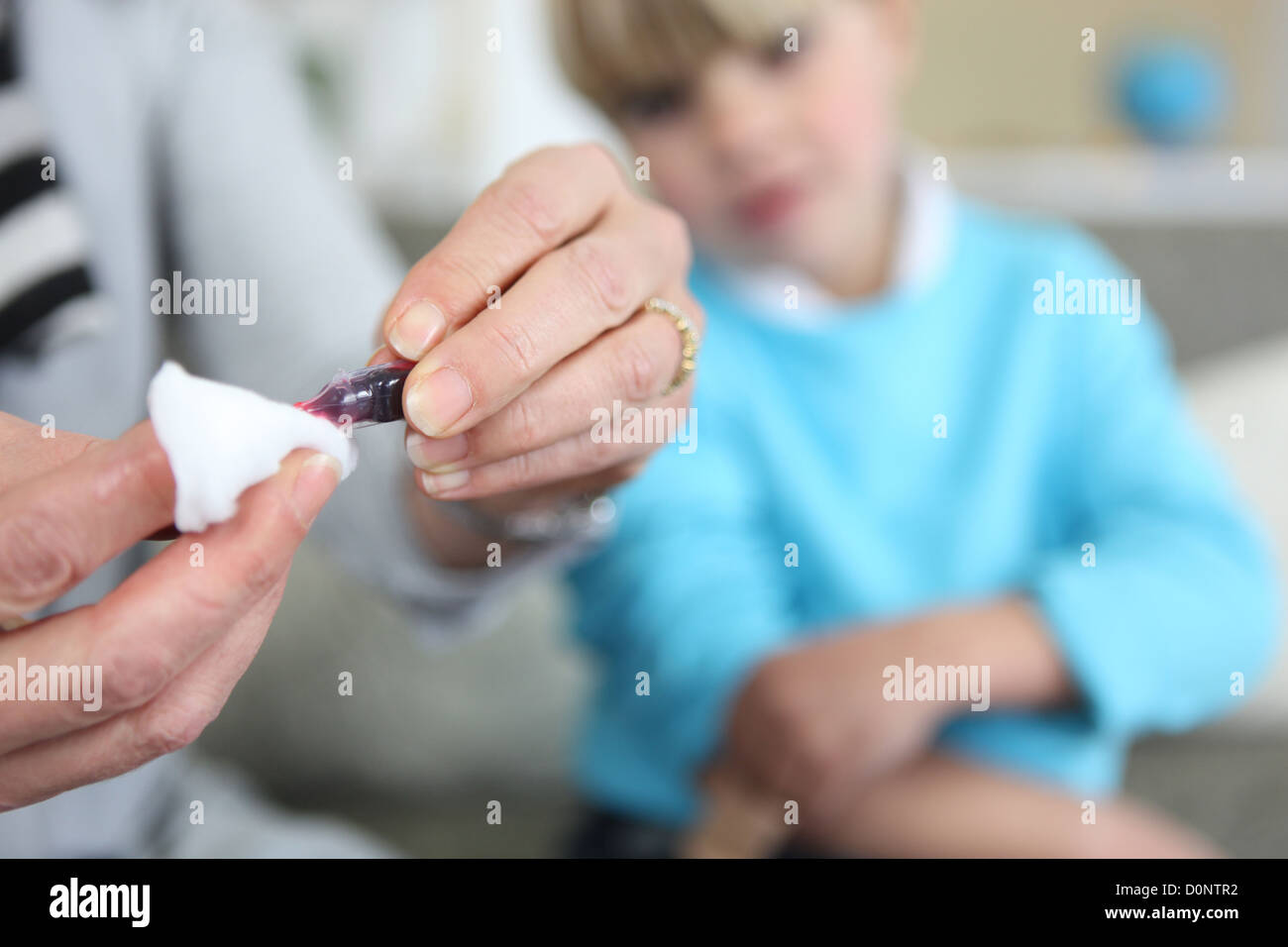 Little boy has had an accident Stock Photo - Alamy