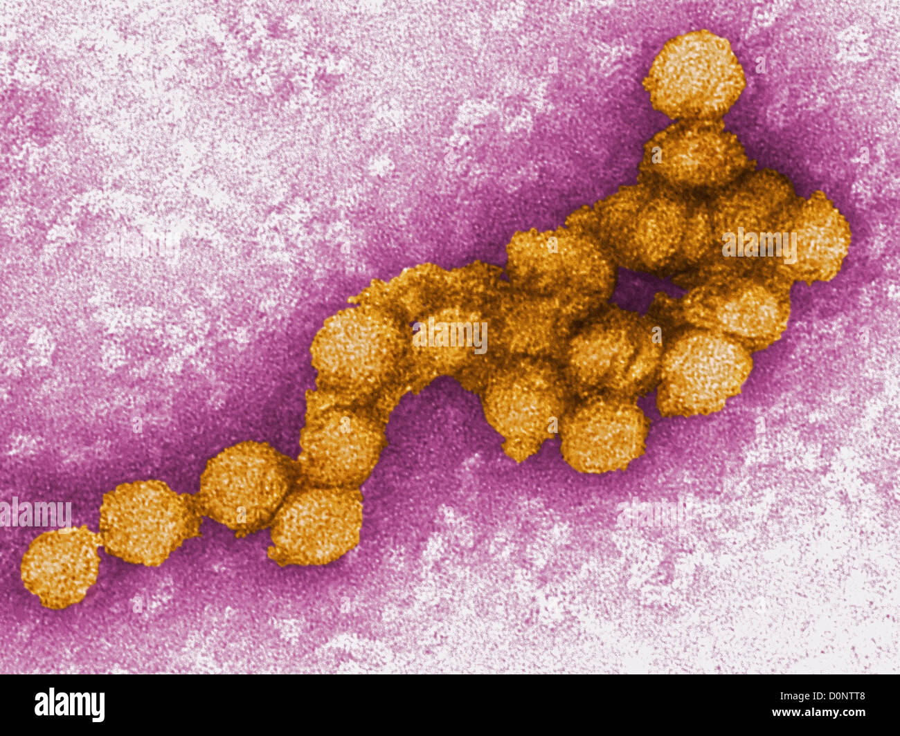 An electron micrograph West Nile virus. West Nile virus is flavivirus ...