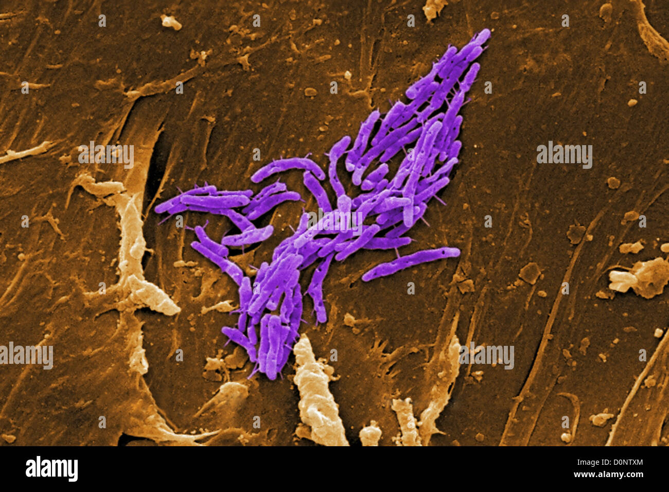 Scanning electron microscopy bacteria hi-res stock photography and ...