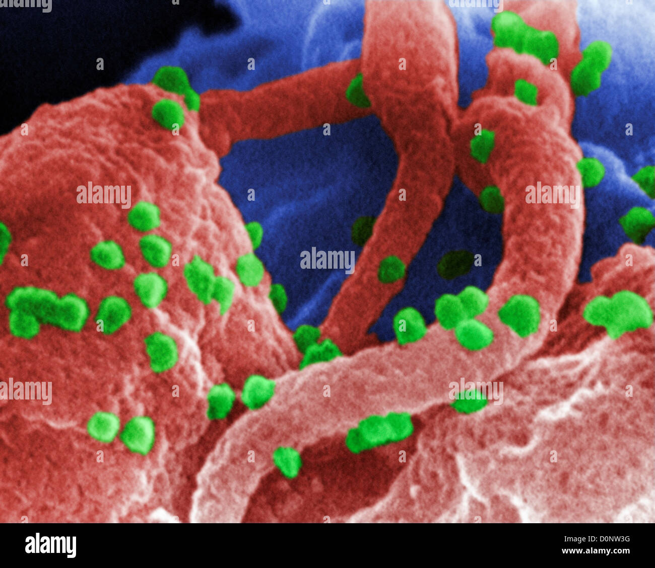 Scanning electron micrograph of hiv 1 hi-res stock photography and ...