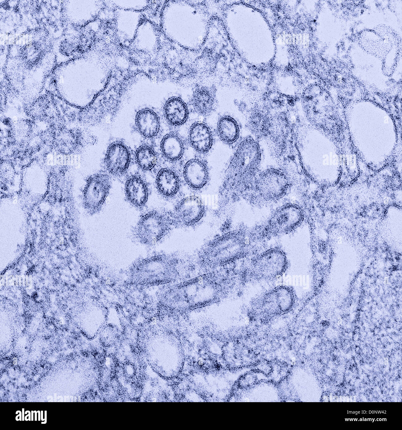 This colorized transmission electron micrograph (TEM) revealed presence ...