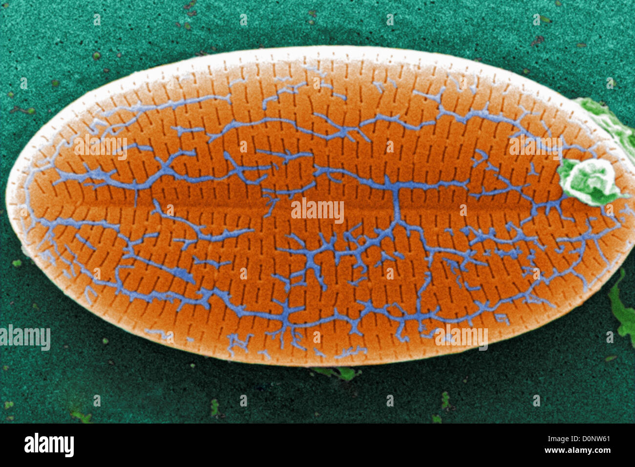 This digitally-colorized scanning electron micrograph (SEM) untreated ...