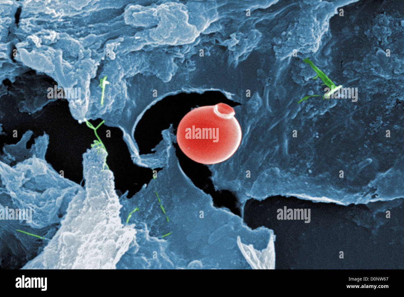 This digitally-colorized scanning electron micrograph (SEM) untreated ...