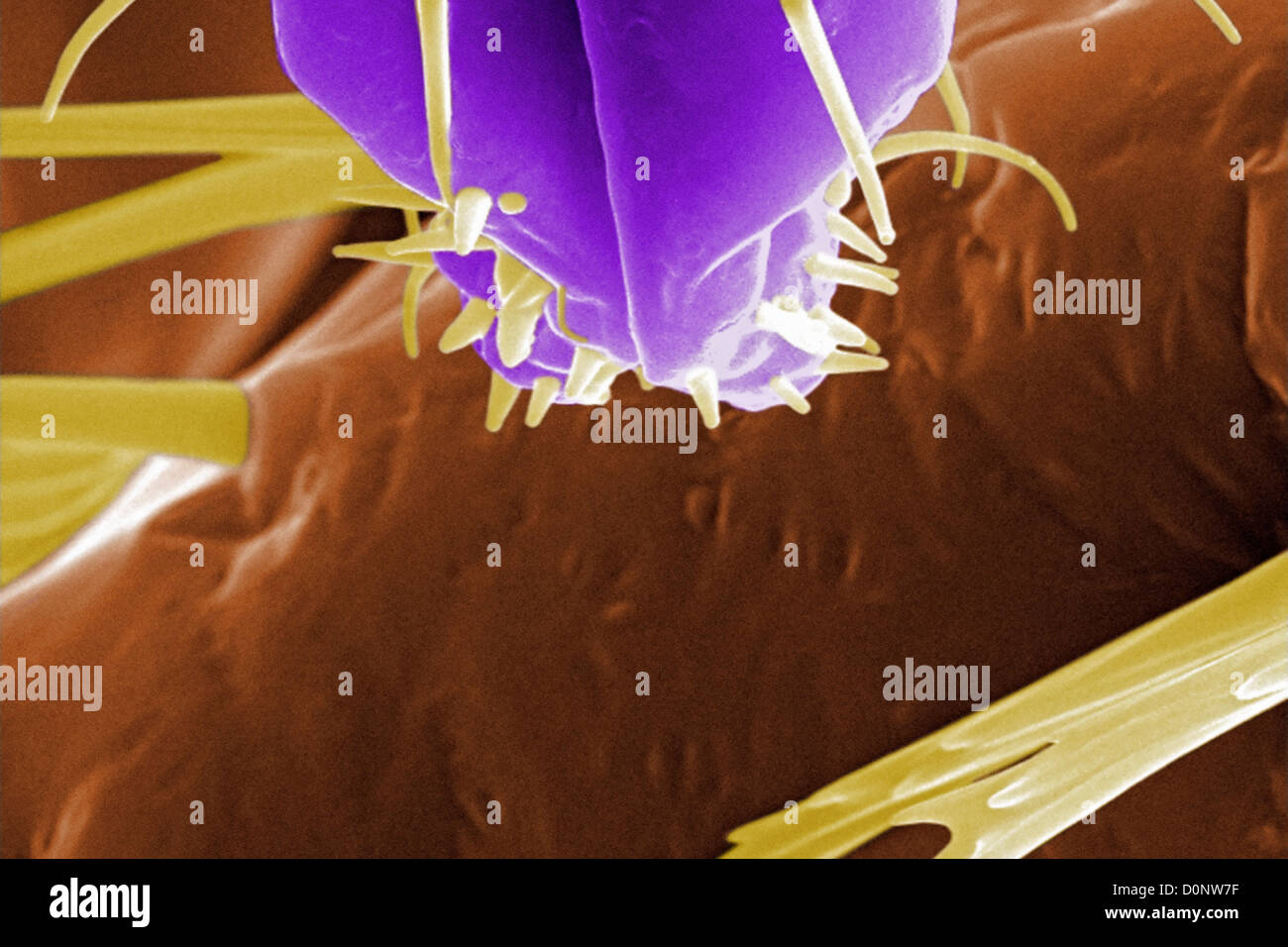 This highly-magnified digitally-colorized scanning electron micrograph ...