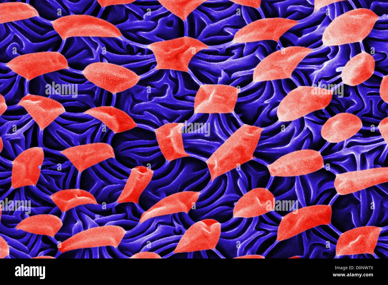 A digitally-colorized close-up scanning electron micrograph (SEM ...