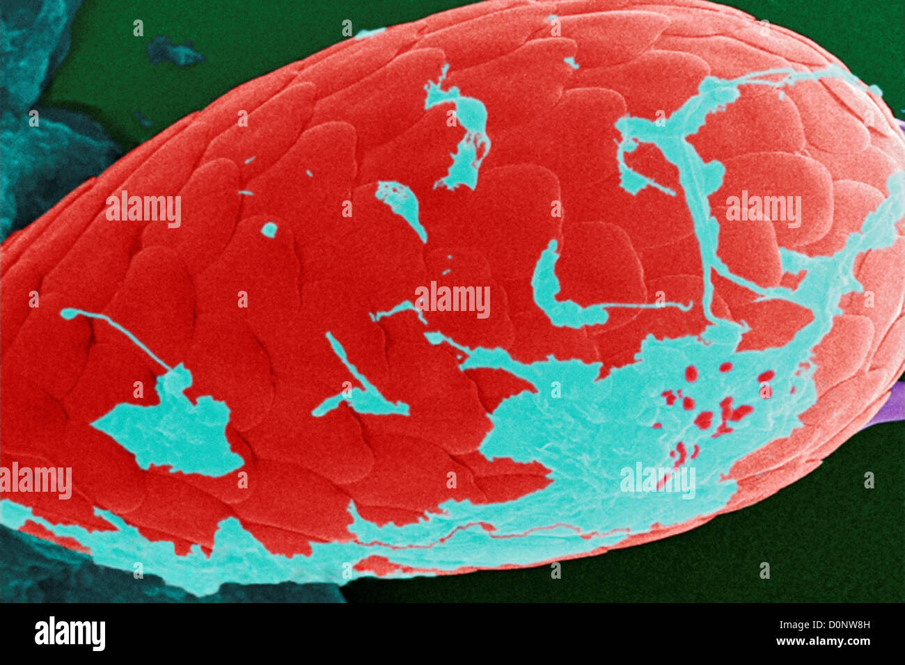 2000x magnification hi-res stock photography and images - Alamy