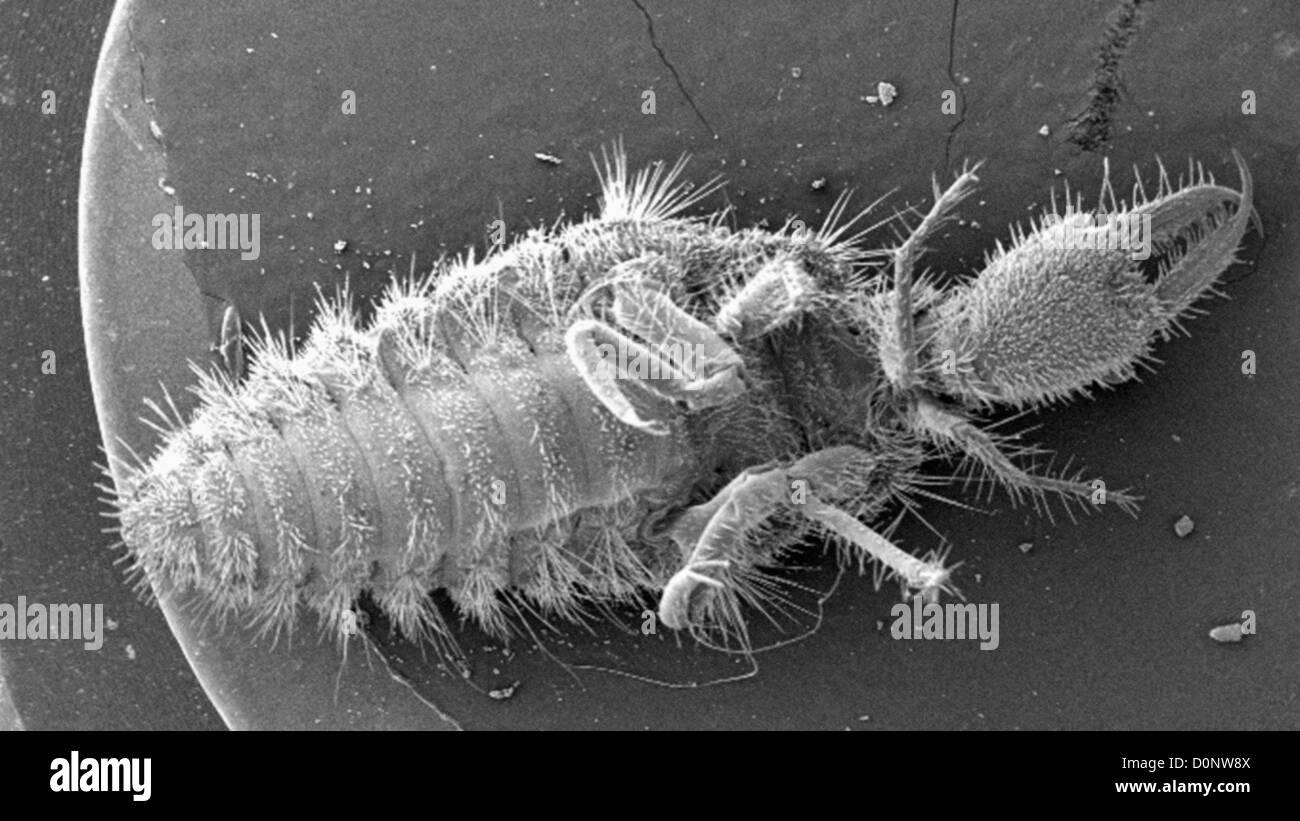 Under very low magnification 13X this scanning electron micrograph ...