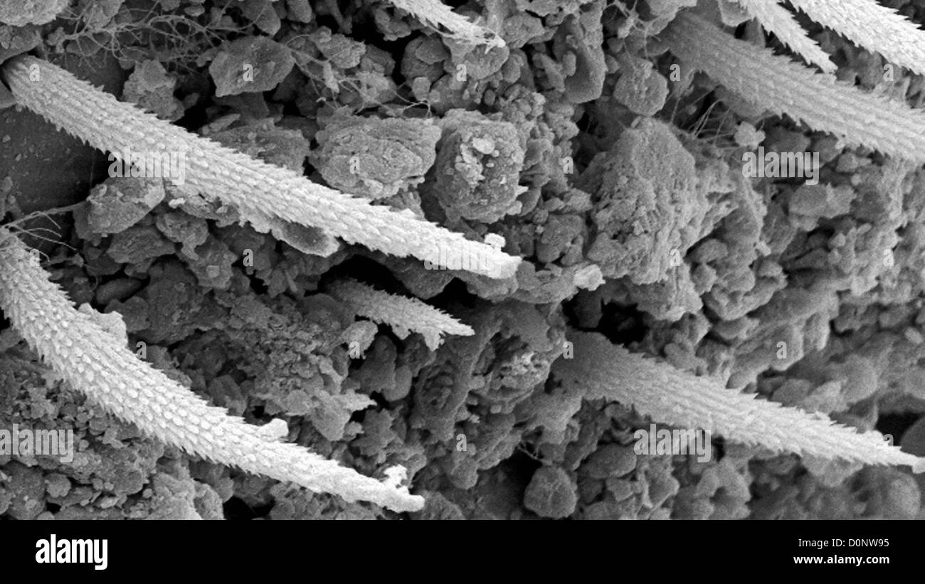 Black and white scanning electron micrograph Black and White Stock ...