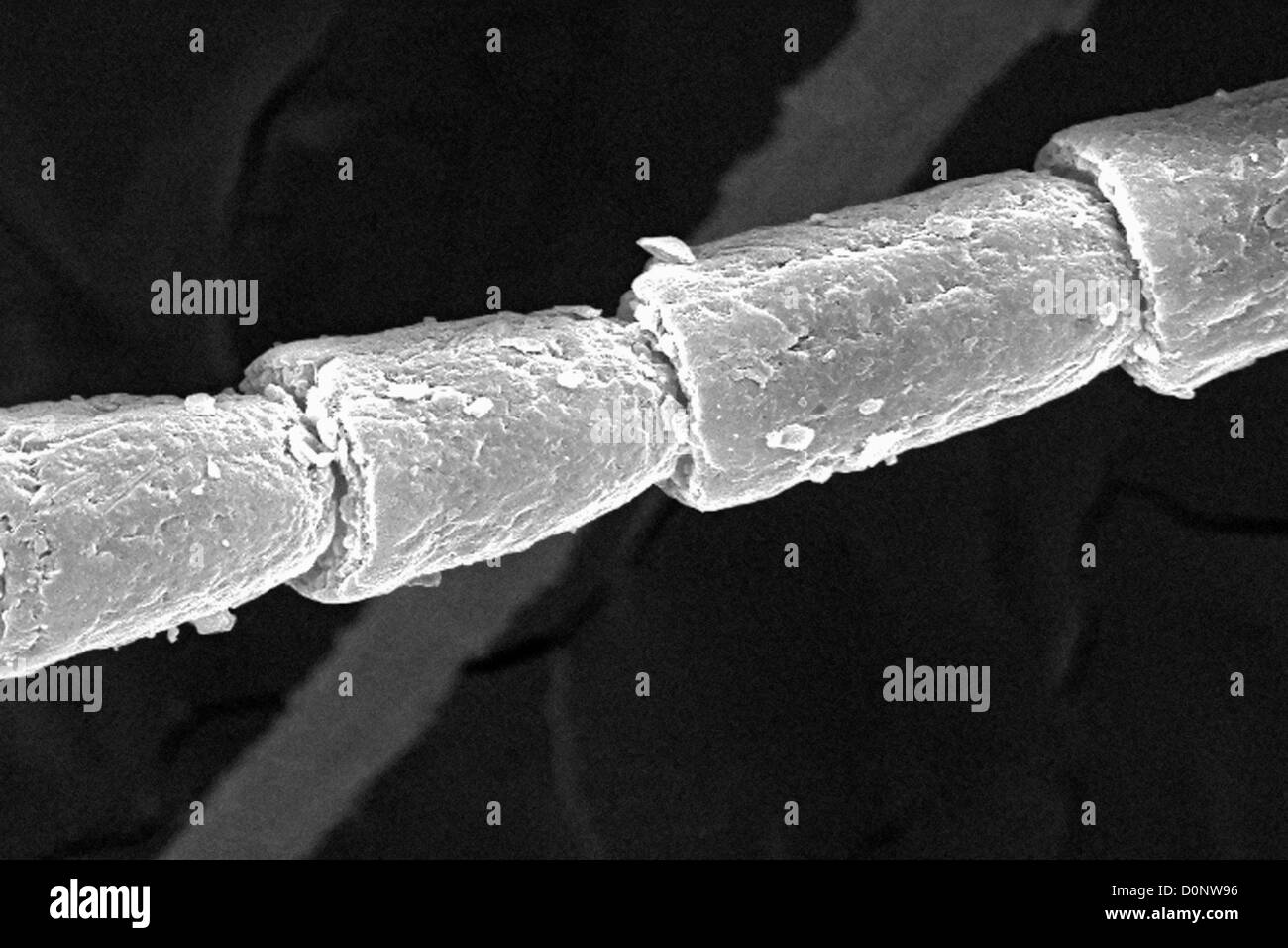 Under moderately-high magnification 1244x this scanning electron ...