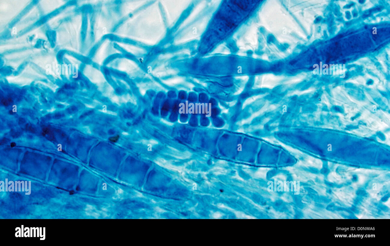 Cleistothecium hi-res stock photography and images - Alamy