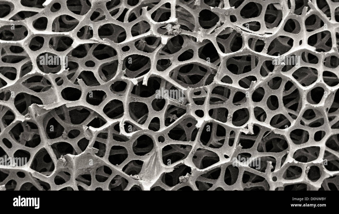 Under low magnification 38x this 2007 scanning electron micrograph (SEM ...