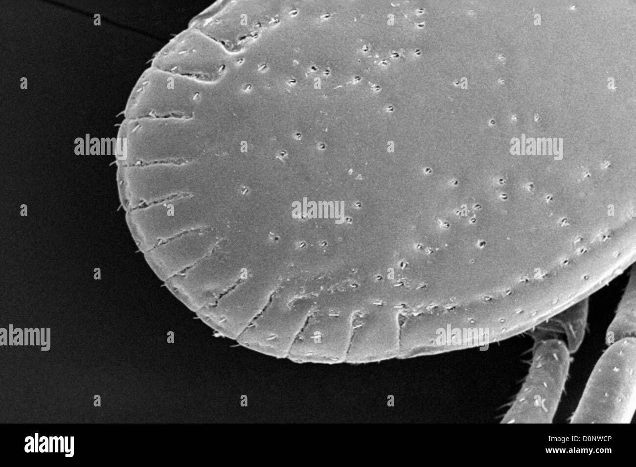 Under low magnification 49X this scanning electron micrograph (SEM ...