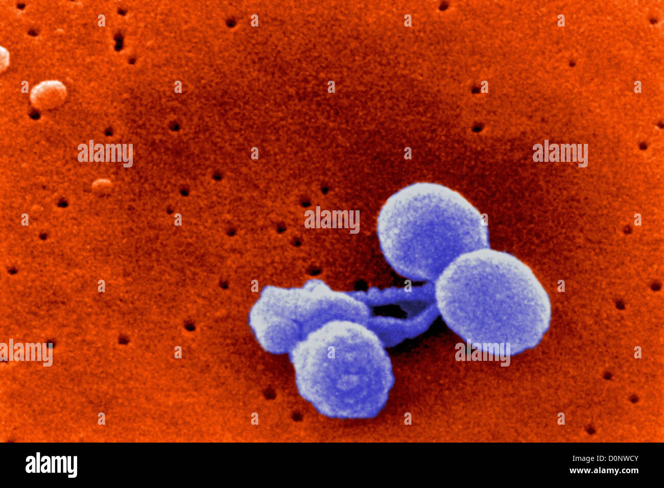 A scanning electron micrograph Streptococcus pneumoniae nasty bactrium ...