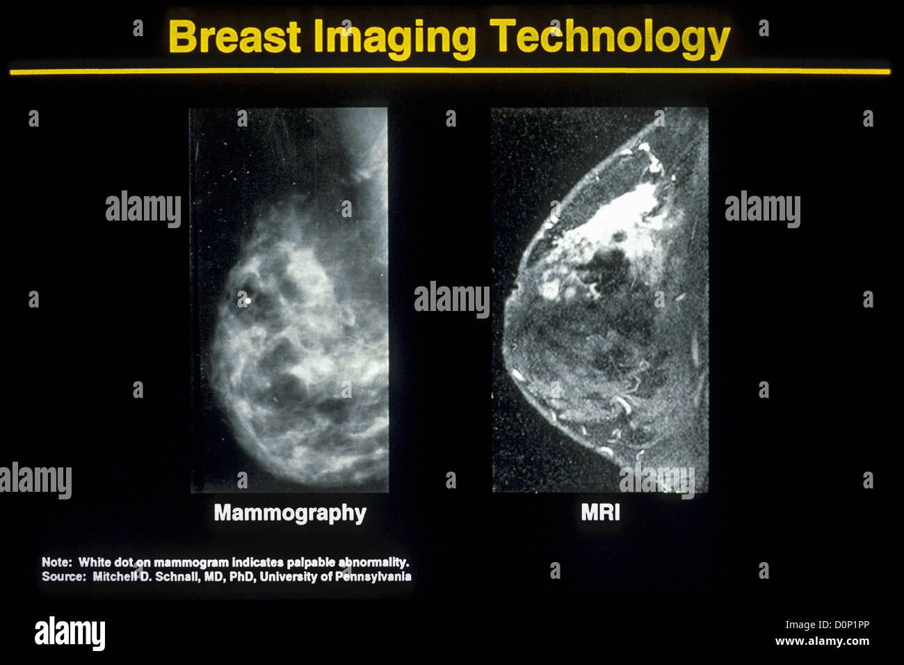 Breast imaging technology has changed over years. mammography in shown ...