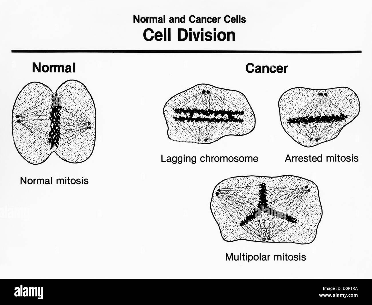An artist's rendition normal cells cancer cells undergoing cell ...