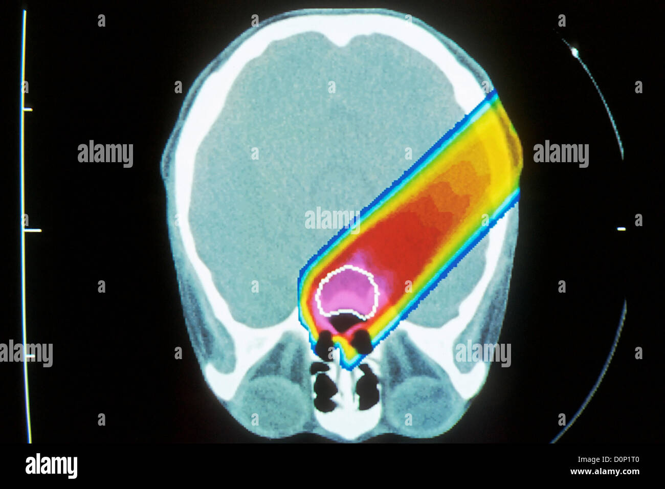 Proton beam hi-res stock photography and images - Alamy