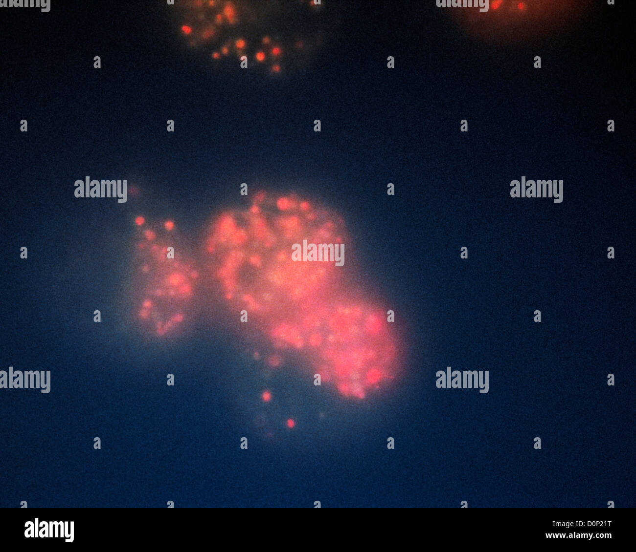 Photofrin being absorbed cancer cells using photodynamic therapy ...