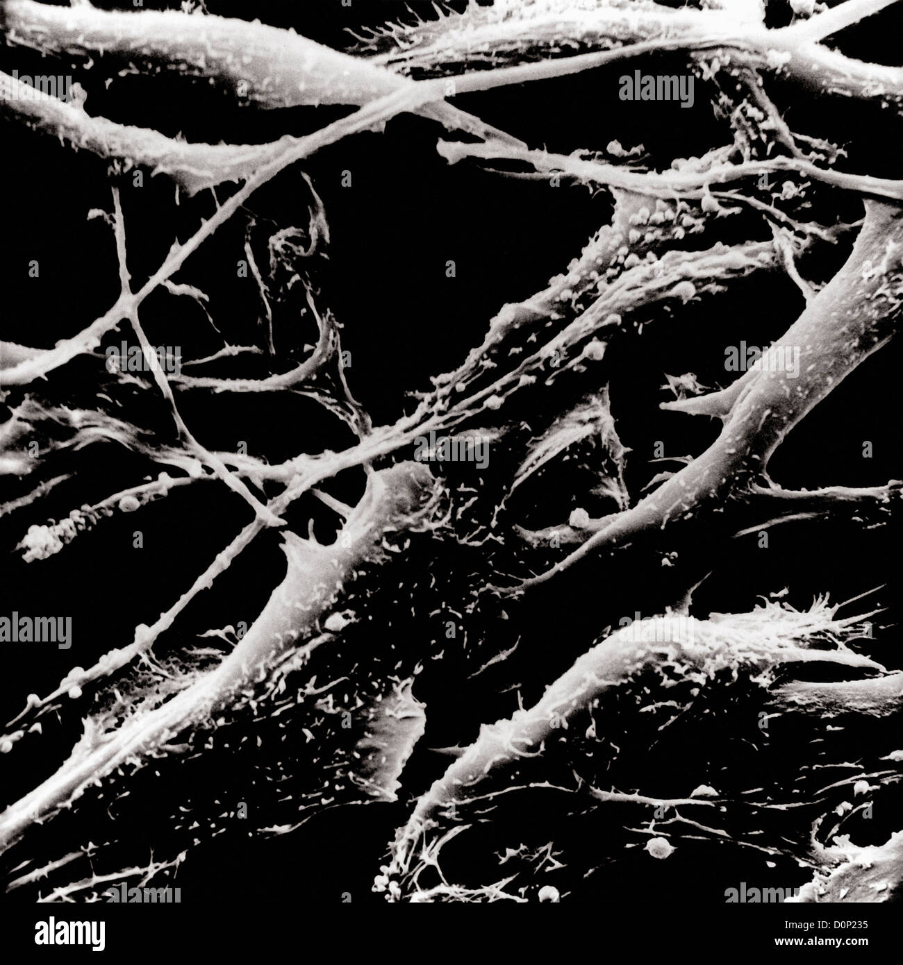 Scanning electron microscope image hi-res stock photography and images ...