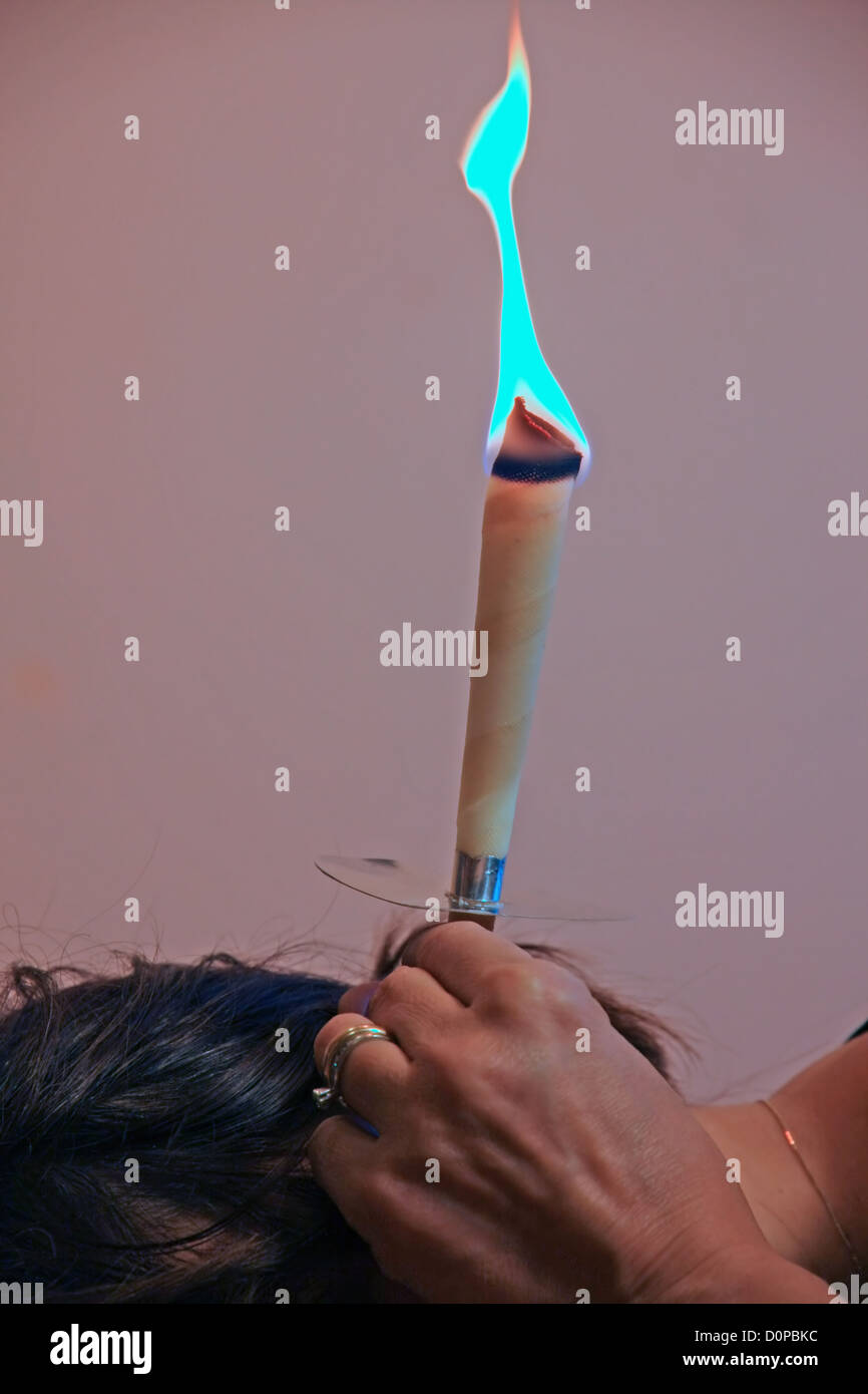 Ear wax removal hi-res stock photography and images - Alamy