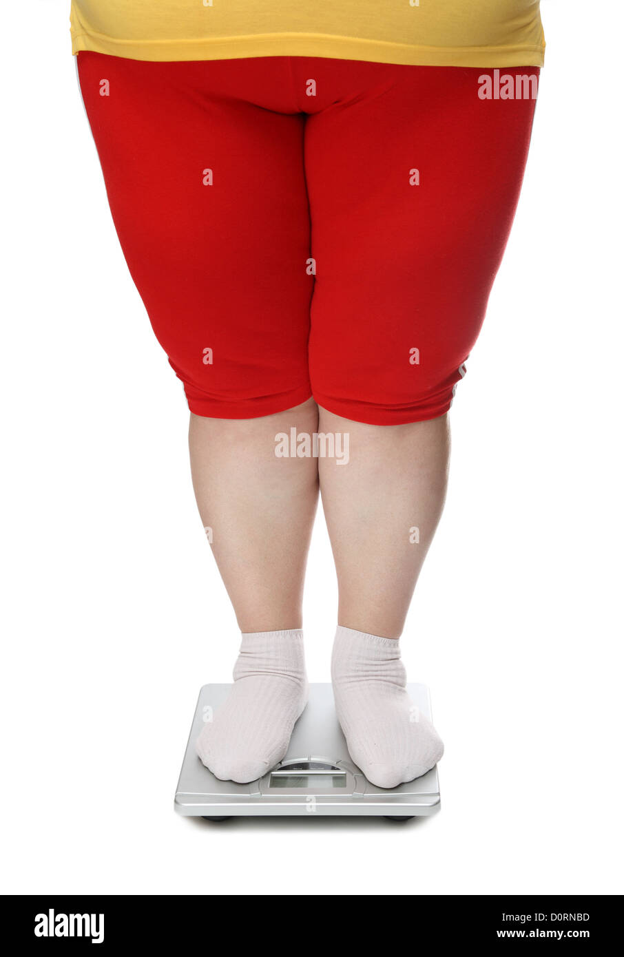women legs with overweight Stock Photo - Alamy