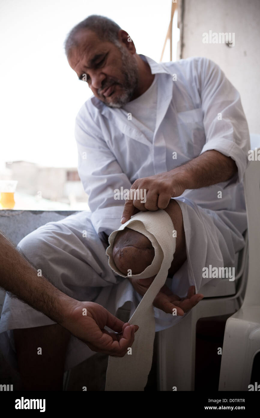 29/09/12, Reyhanli, Turkey. A Syrian man who lost his leg during ...
