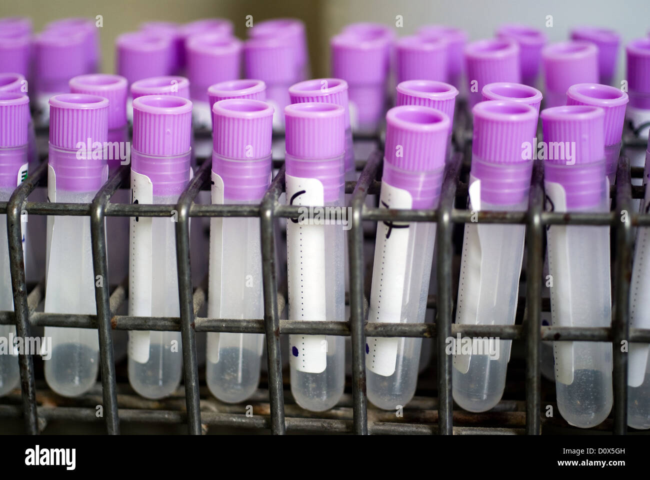 test tubes in metal rack; shallow depth of field Stock Photo - Alamy