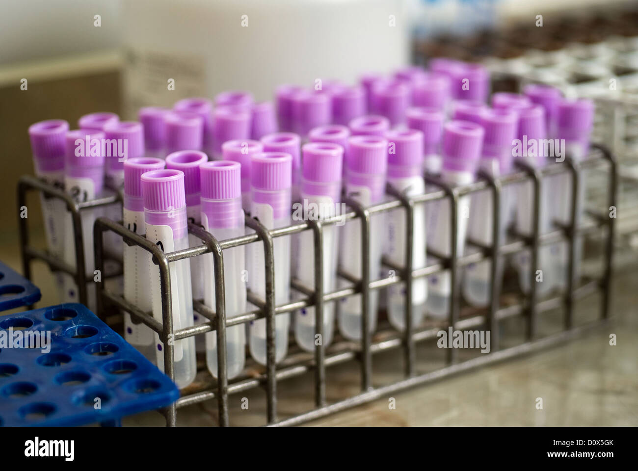test tubes in laboratory; shallow depth of field; focus on first test ...