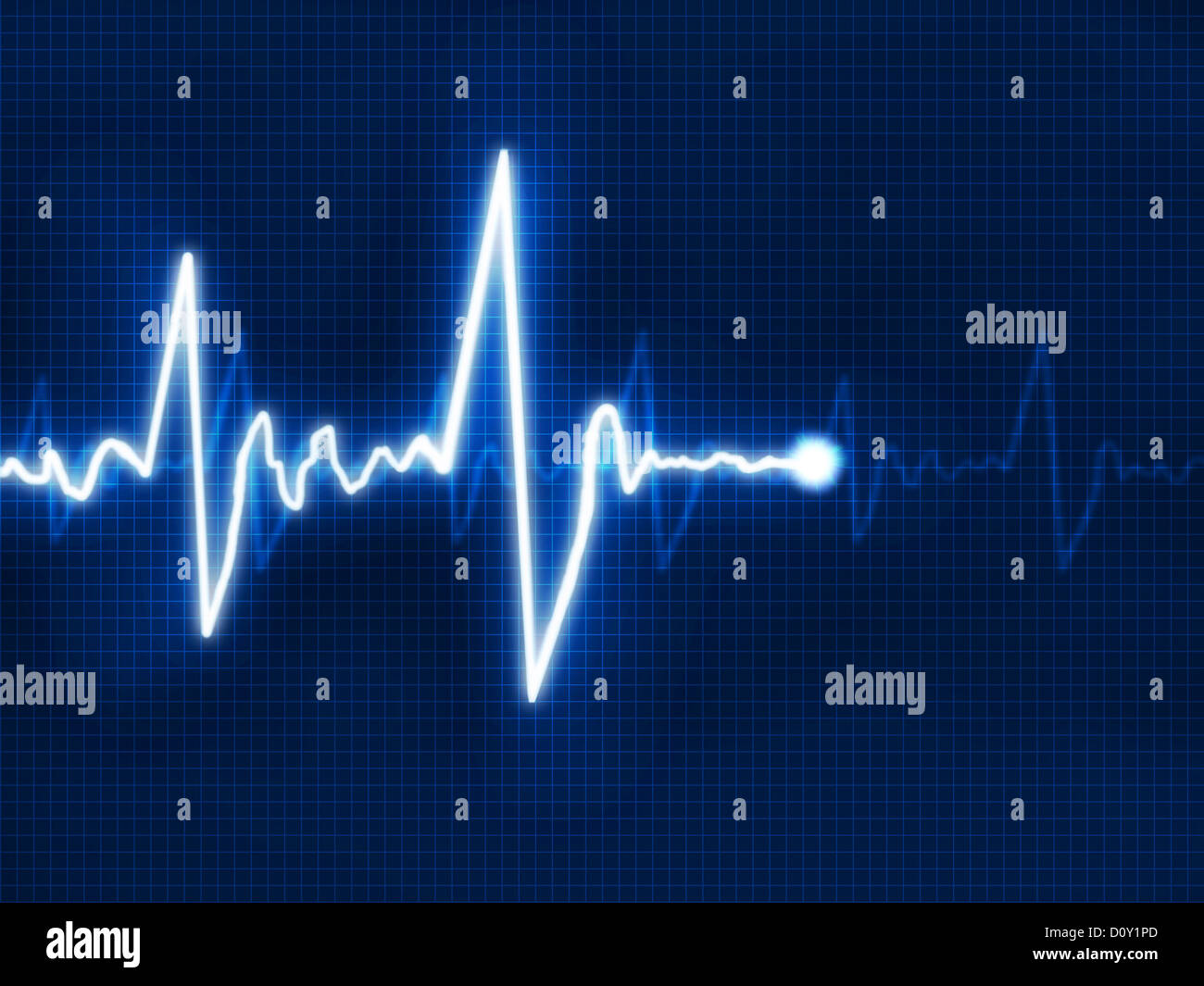 Cardiac cardiogram hi-res stock photography and images - Alamy
