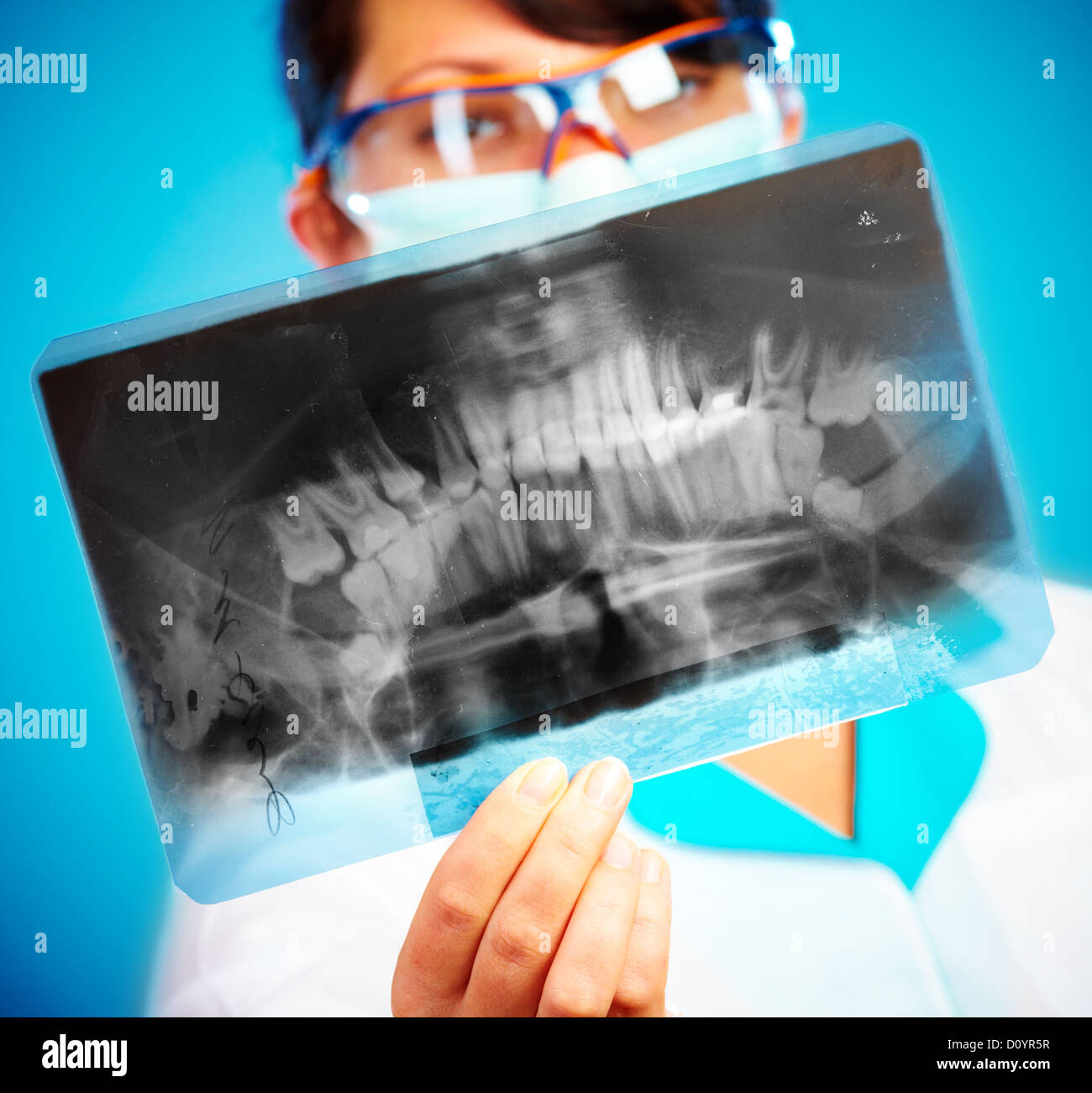 Doctor with xray Stock Photo - Alamy