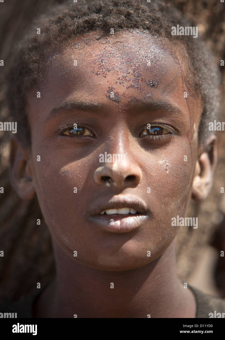 Portrait Of A Karrayyu Tribe Kid With Cow Blood On His Face, Gadaaa ...