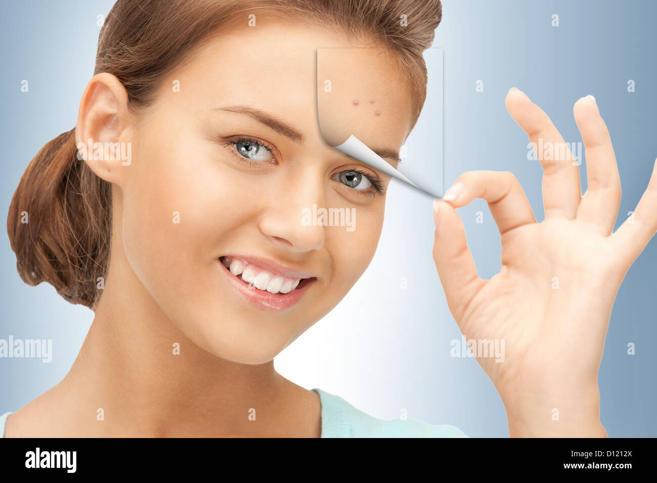 No Acne High Resolution Stock Photography and Images - Alamy
