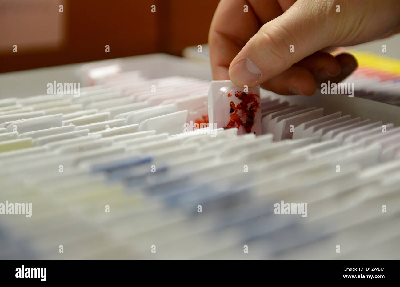 A tissue sample is filed at a lab of the Pathology at Charite Hospital ...