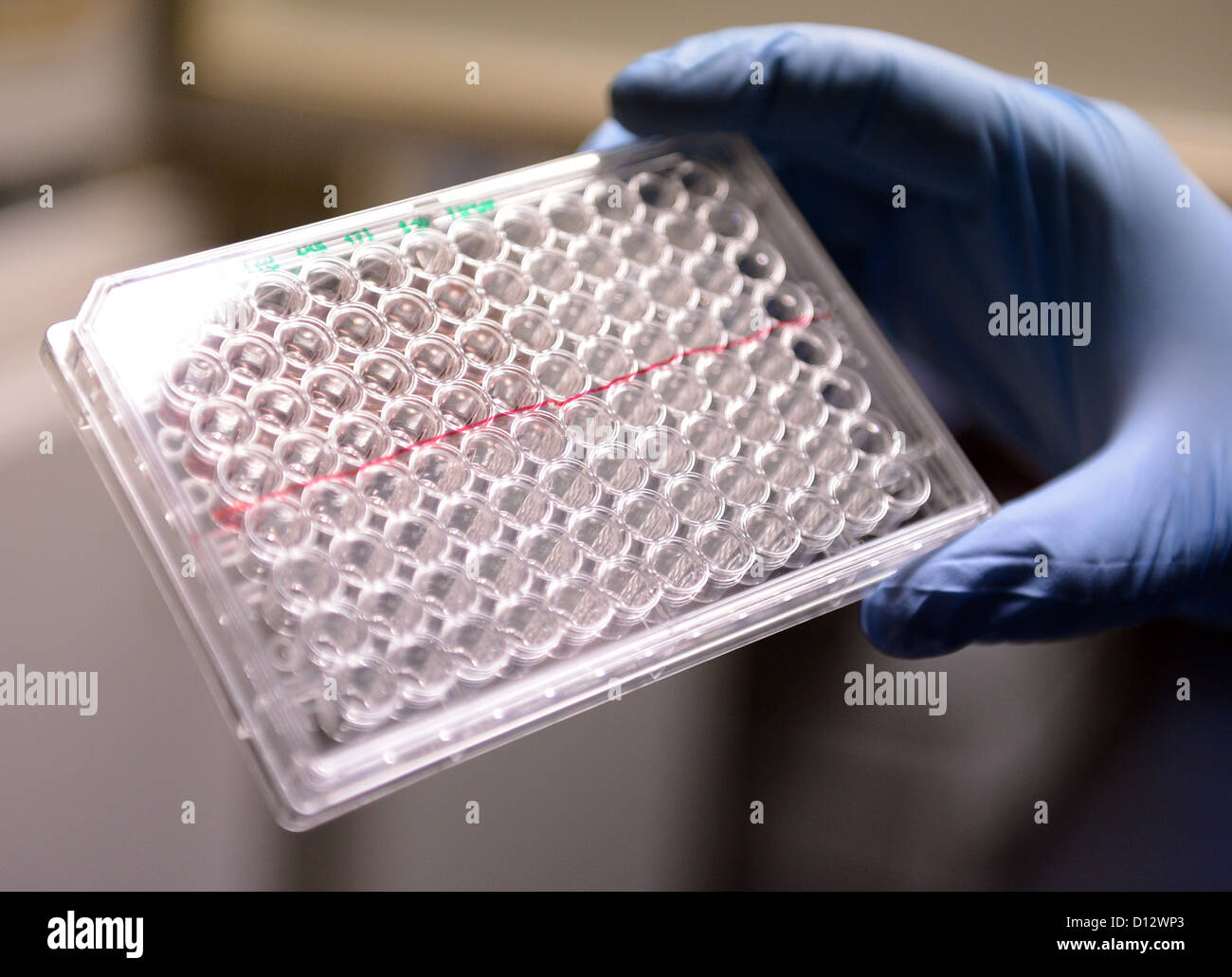 A tissue sample is filed at a lab of the Pathology at Charite Hospital ...