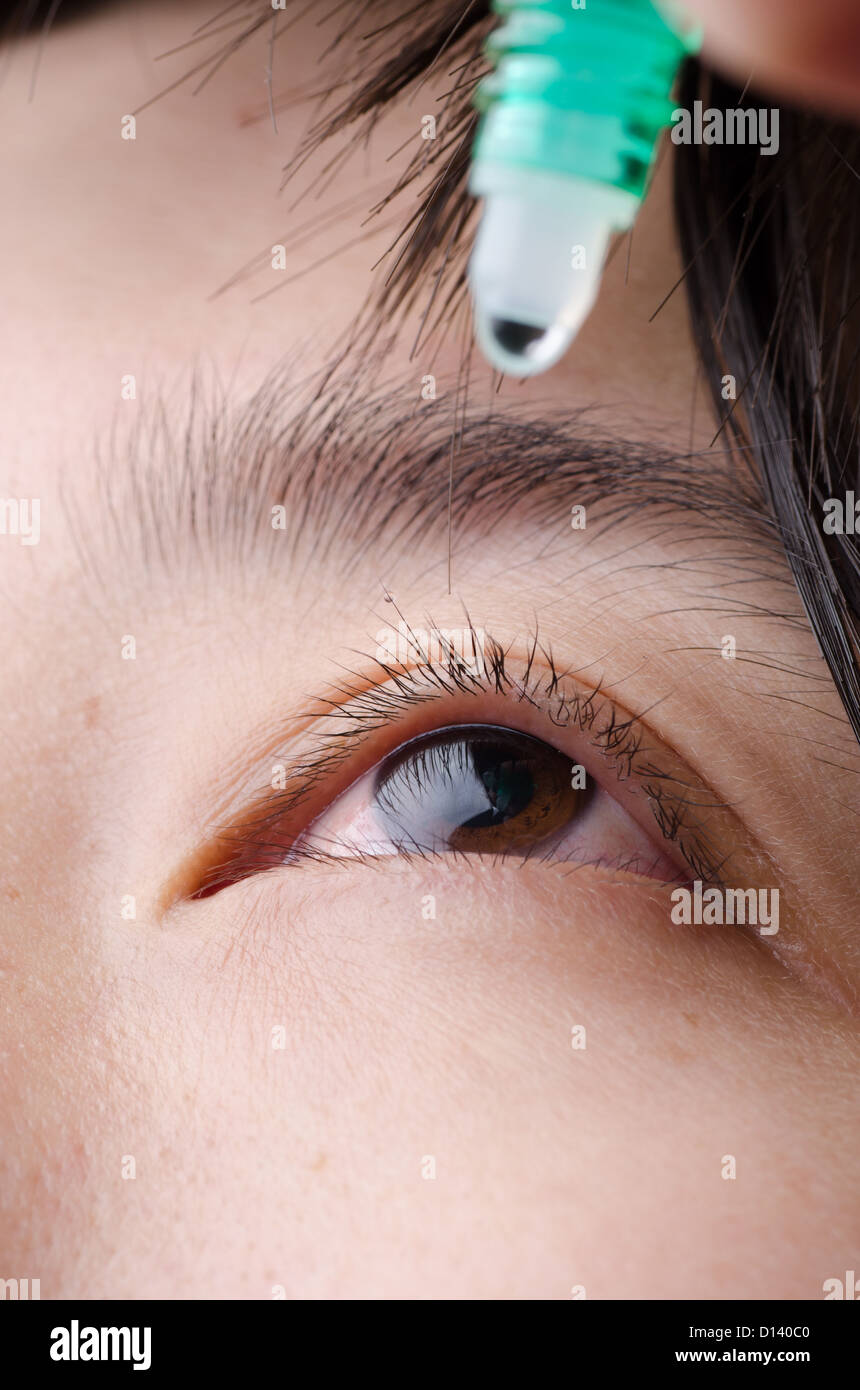 young woman applying eye drop Stock Photo - Alamy