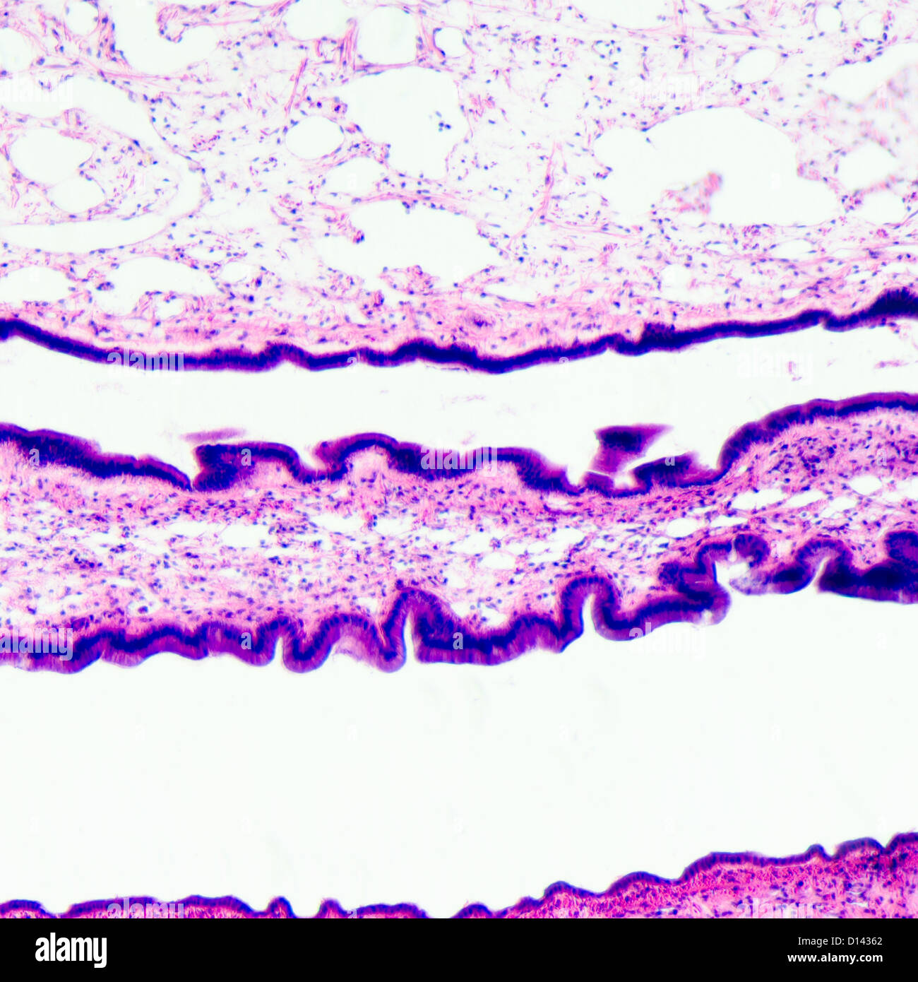 micrograph of medical science cilliated epithelium tissue cell Stock ...