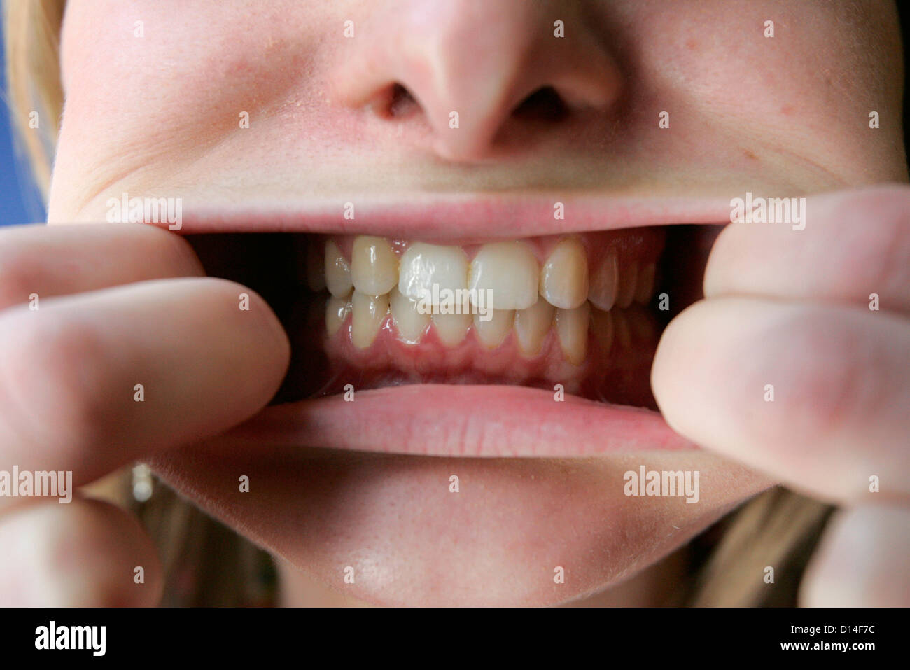 rictus smile grin grimace Stock Photo - Alamy