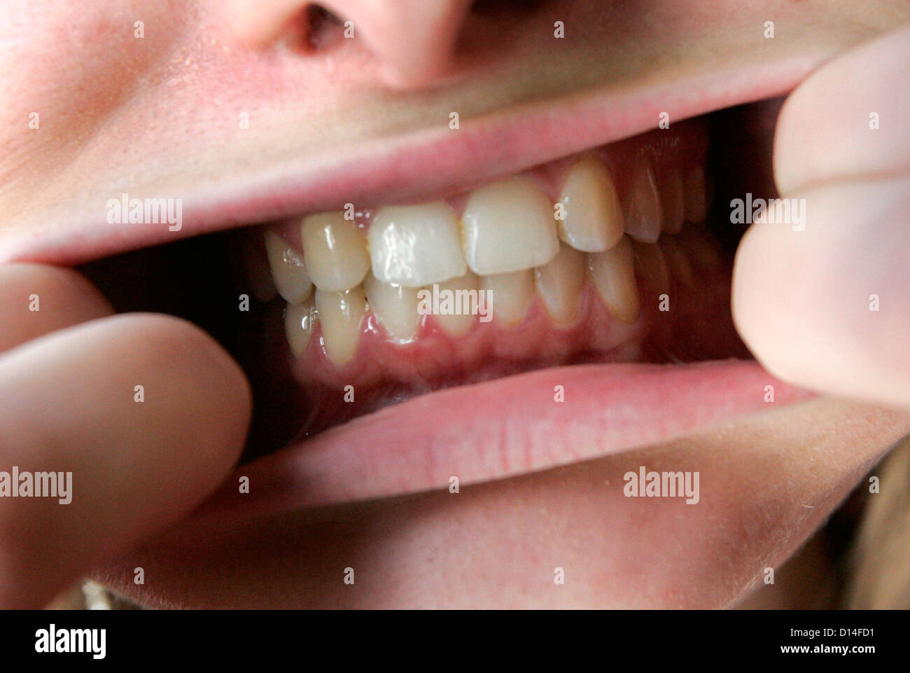 mouth teeth gums rictus grin Stock Photo - Alamy