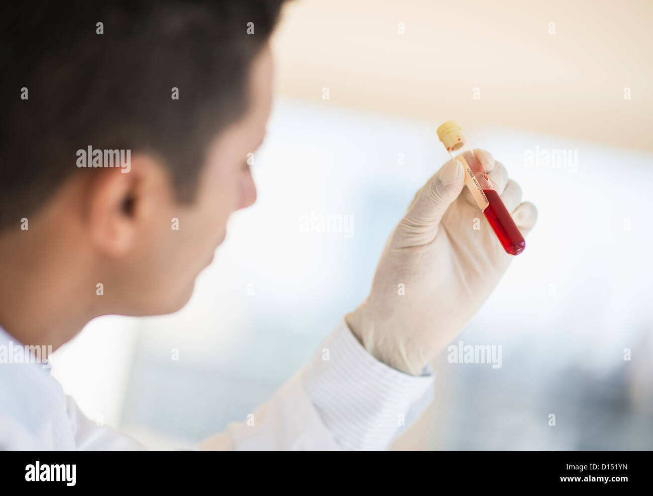 Technician holding blood sample Stock Photo - Alamy